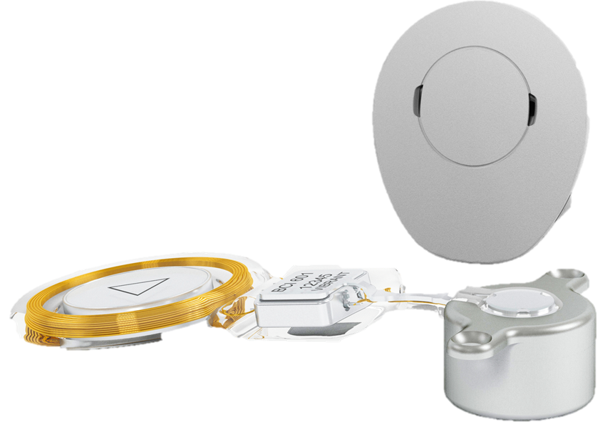 BONEBRIDGE - Auditory Implant Service